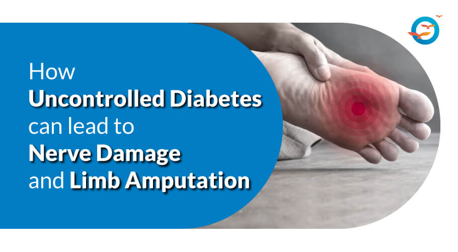 How uncontrolled diabetes can lead to nerve damage and limb amputation ...